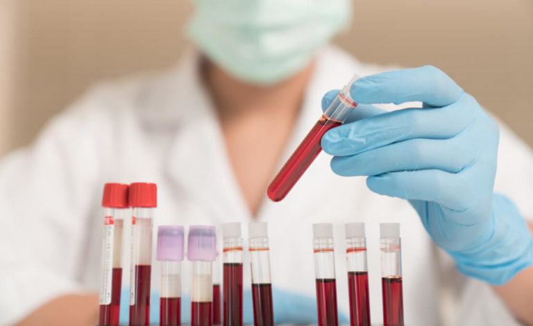 Blood Testing Services - Precision Labs